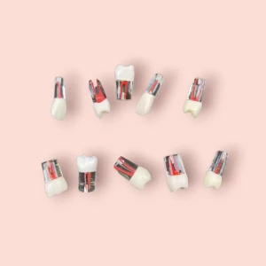 Lower left lateral incisor (32)